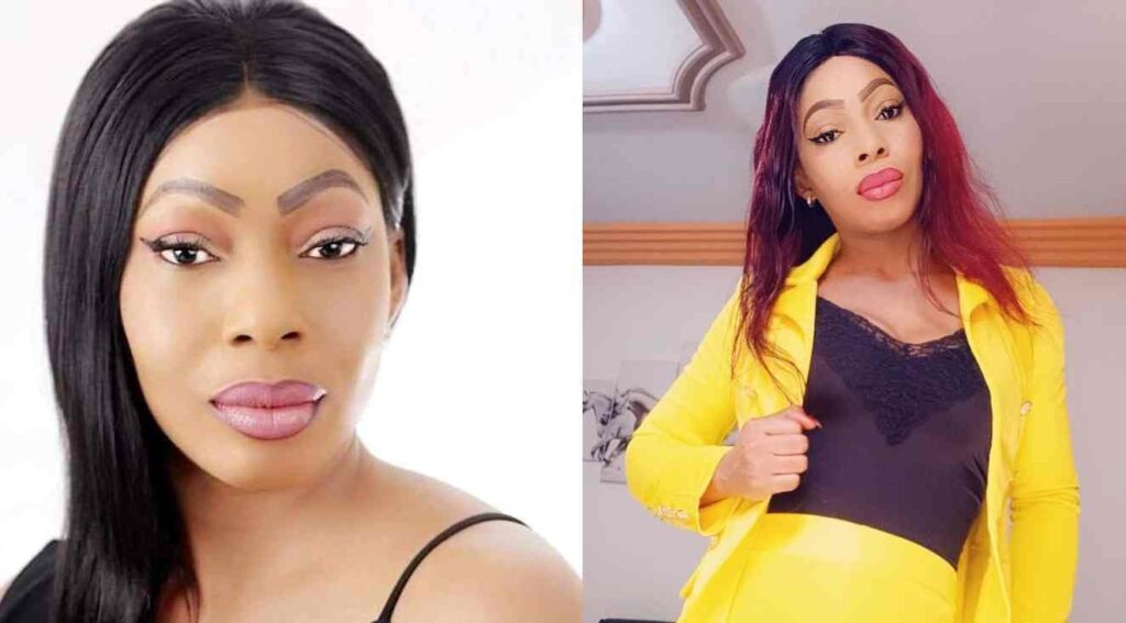 Lolo Beauté bbl opération fesses chirurgie esthétique